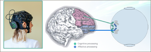 fNIRS in neuromarketing | Neurensics neuro-marktonderzoeksbureau